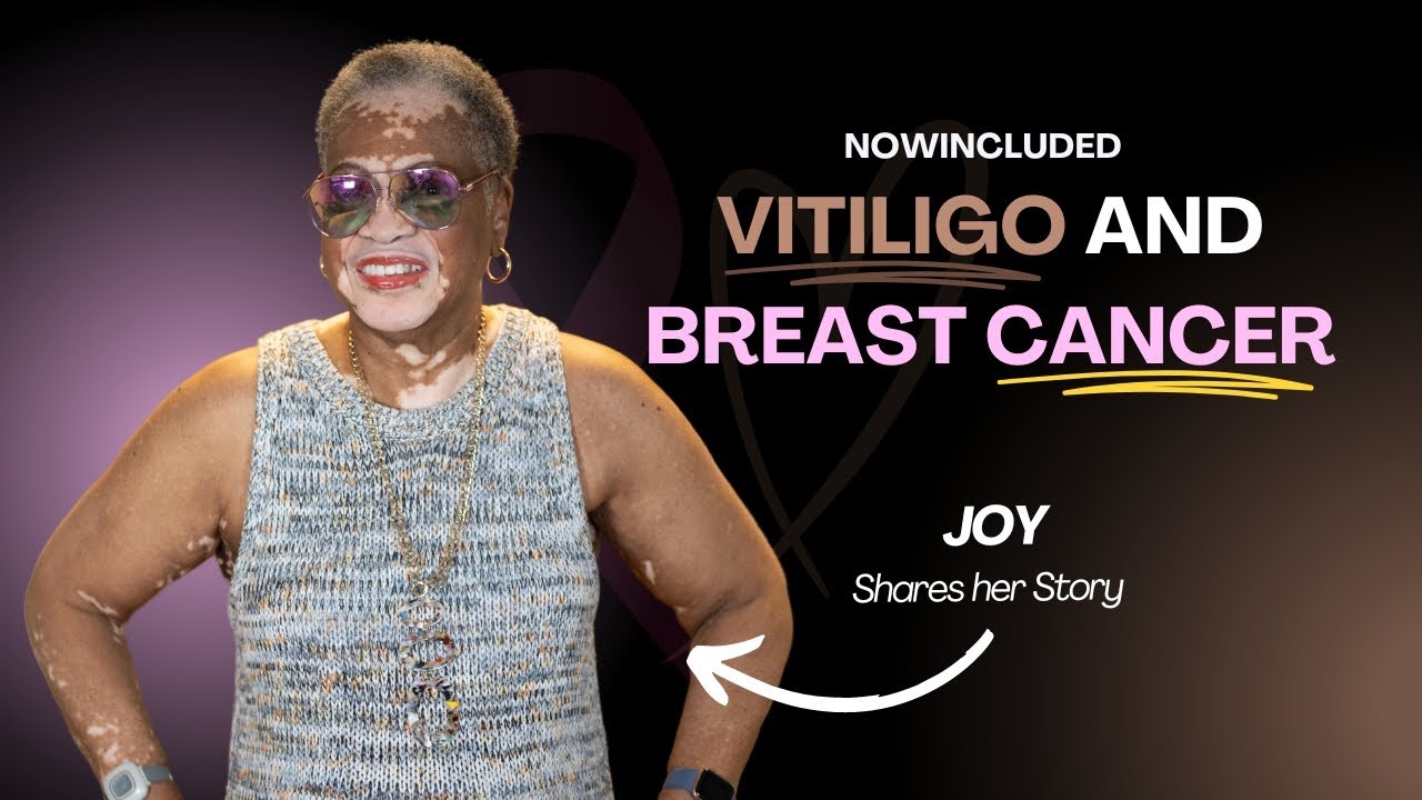 Joyfully Facing Vitiligo and Breast Cancer: A Journey of Strength - YouTube