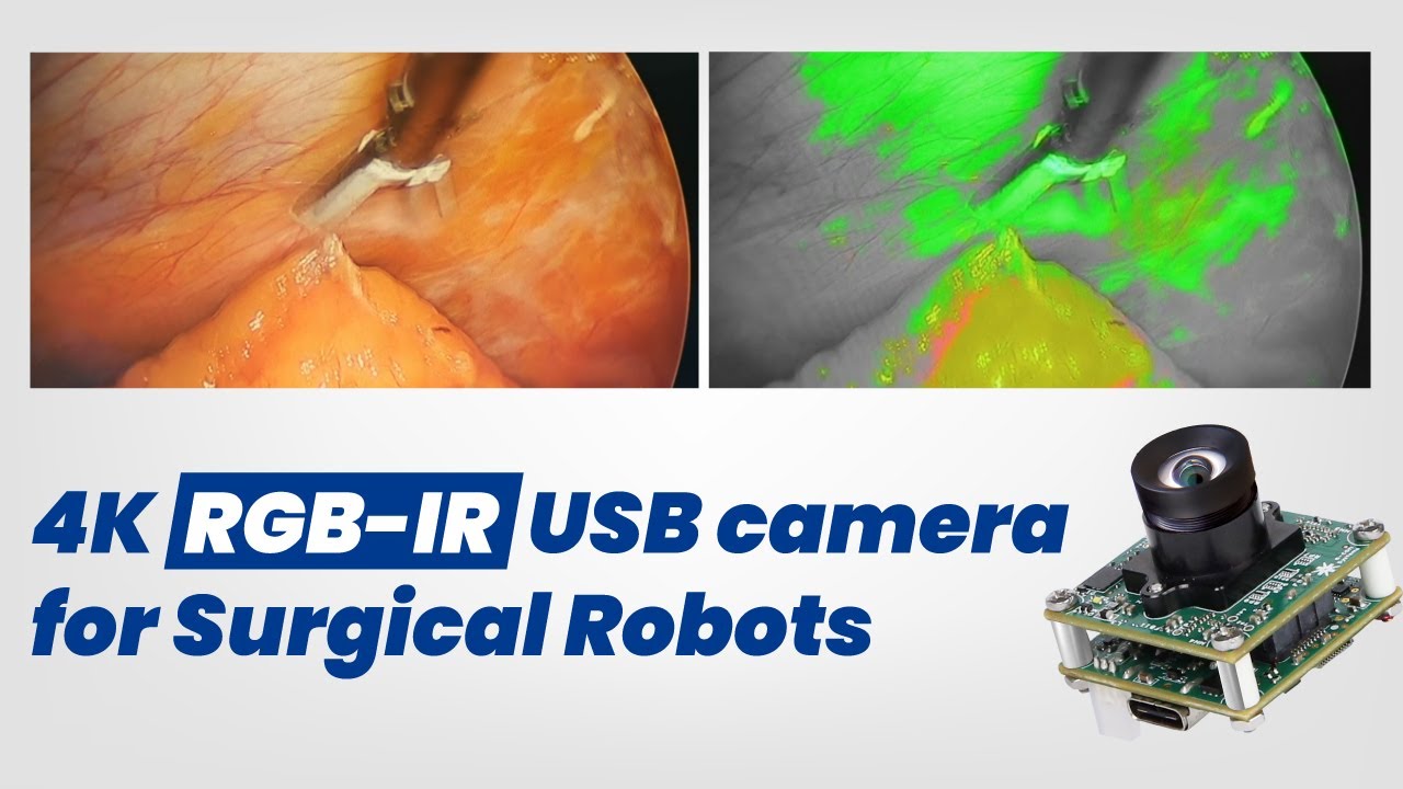 8MP RGB-IR USB camera for Surgical Robots | Simultaneous RGB & IR ...