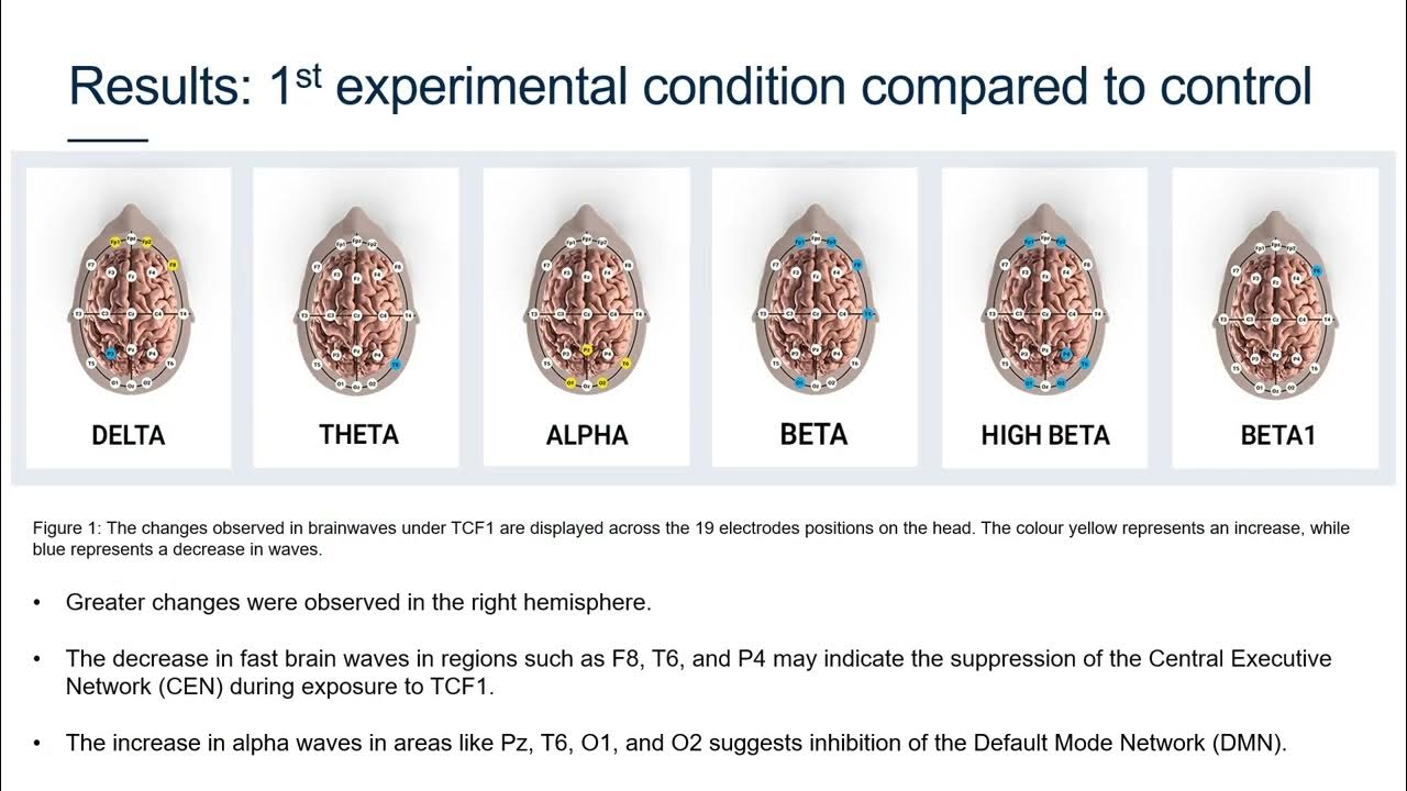 Effects of T Consciousness Fields on Brain Mapping Using Quantitative Electroencephalogram QEEG ...