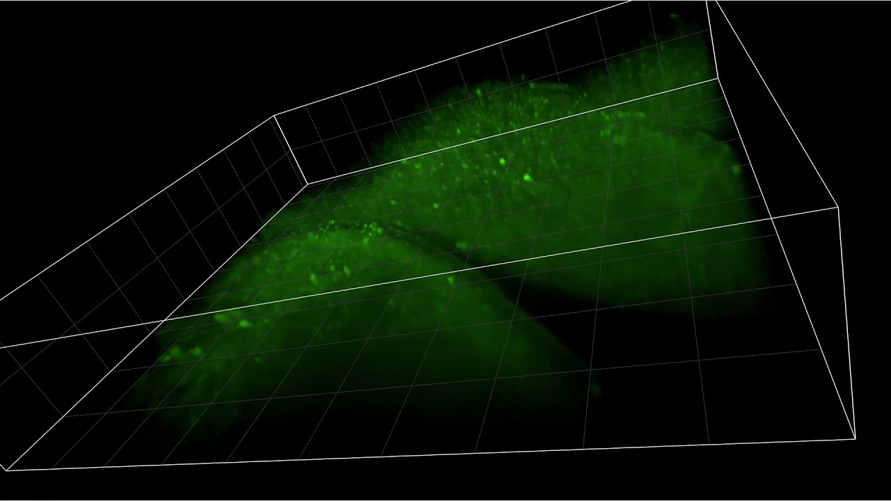 Imaging of intact olfactory epithelium using SCAPE microscopy - YouTube