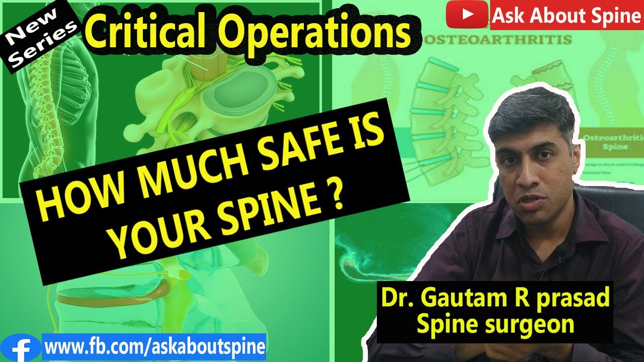 CRITICAL OPERATIONS || HEALTH TIPS || HEALTH TALKS || SPINE PROBLEMS ...