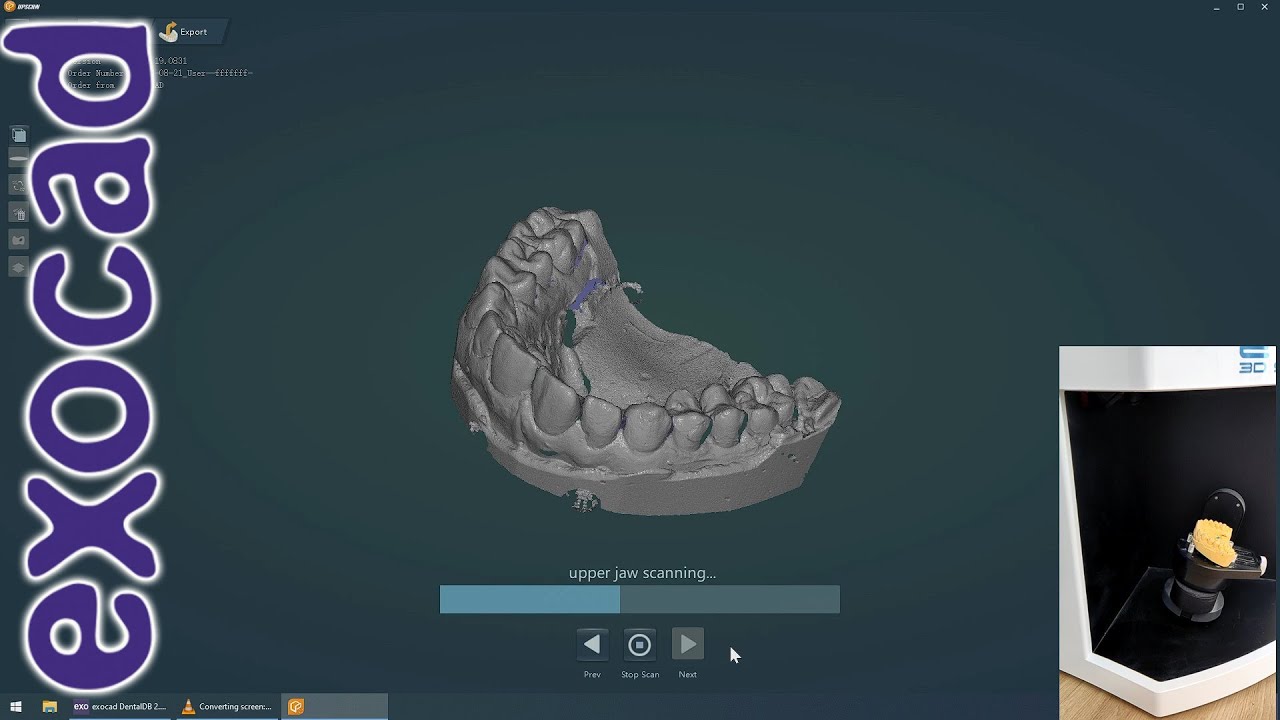 The Process of Casting the Dental Impression, trimming and scanning ...