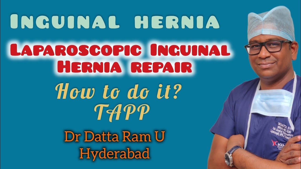 Inguinal Hernia , Laparoscopic repair, Technique and TIPS for TAPP ...