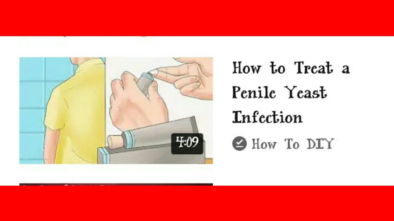HOW TO TREAT A PINE YEAST INFECTIONS - YouTube