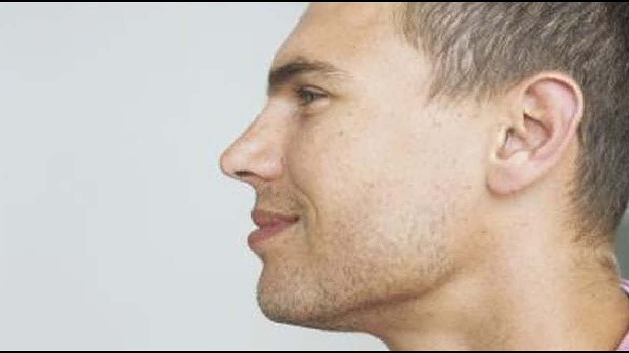 how to get rid of jowls without surgery - YouTube