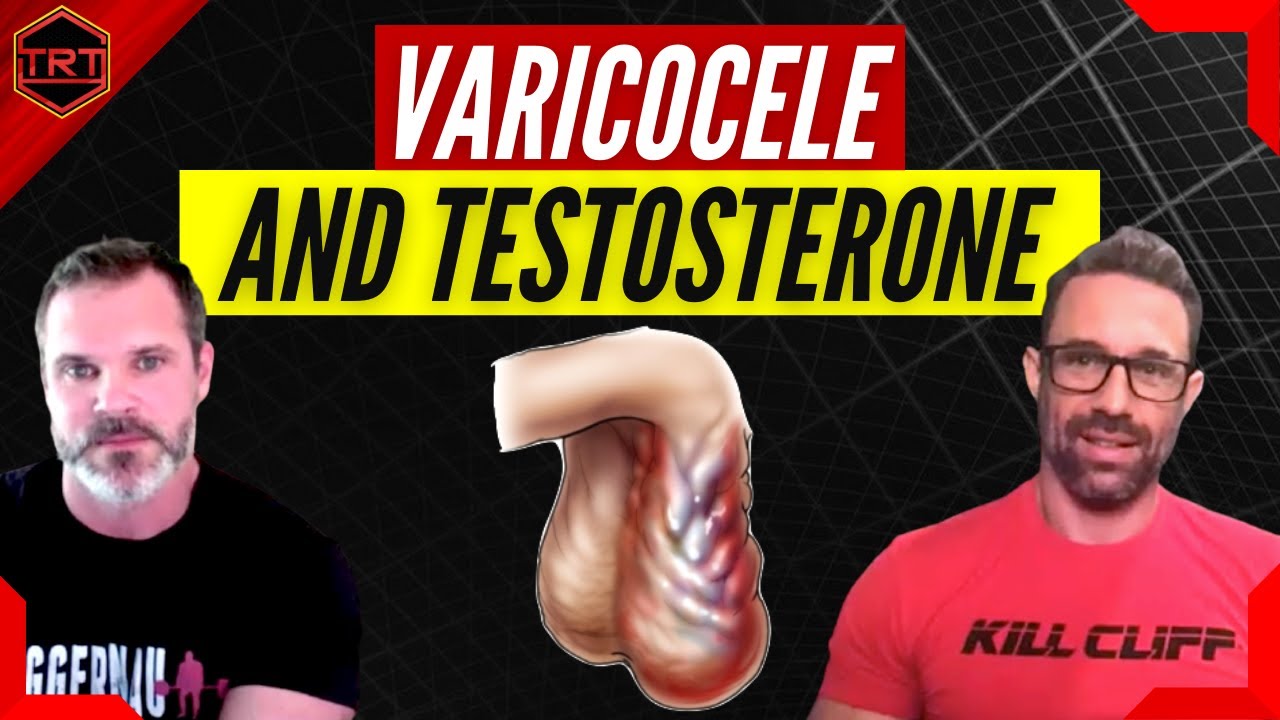 Can Varicocele Lower Testosterone Levels? Varicocele E Testosterona ...
