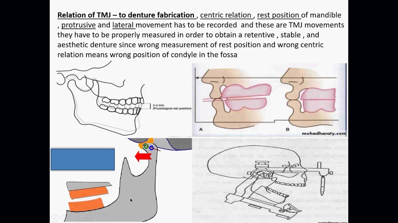 LEC , 8 2ND Y, TMJ, centric relation - YouTube