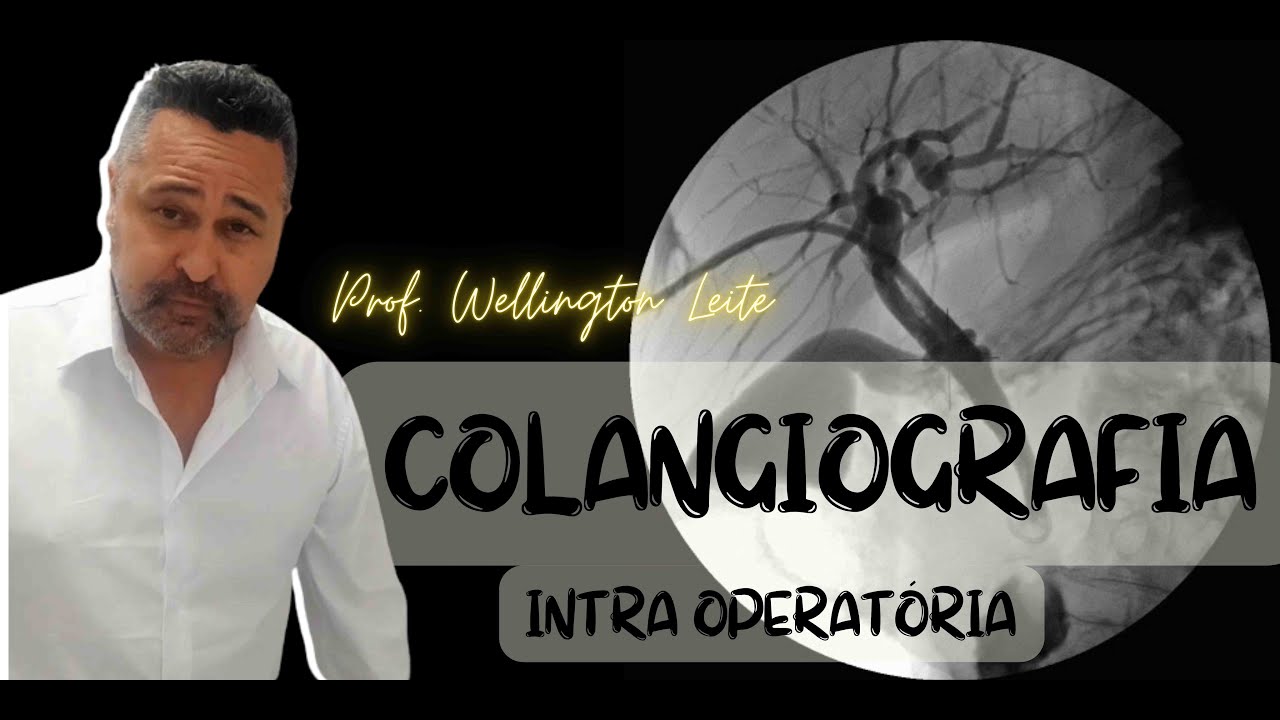 COLANGIOGRAFIA INTRA OPERATÓRIA - YouTube