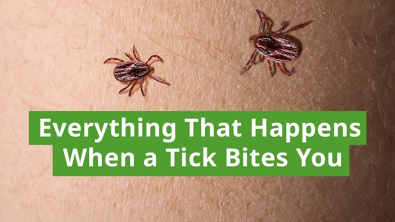 How Ticks Spread Disease: The Hidden Process of Transmission - YouTube