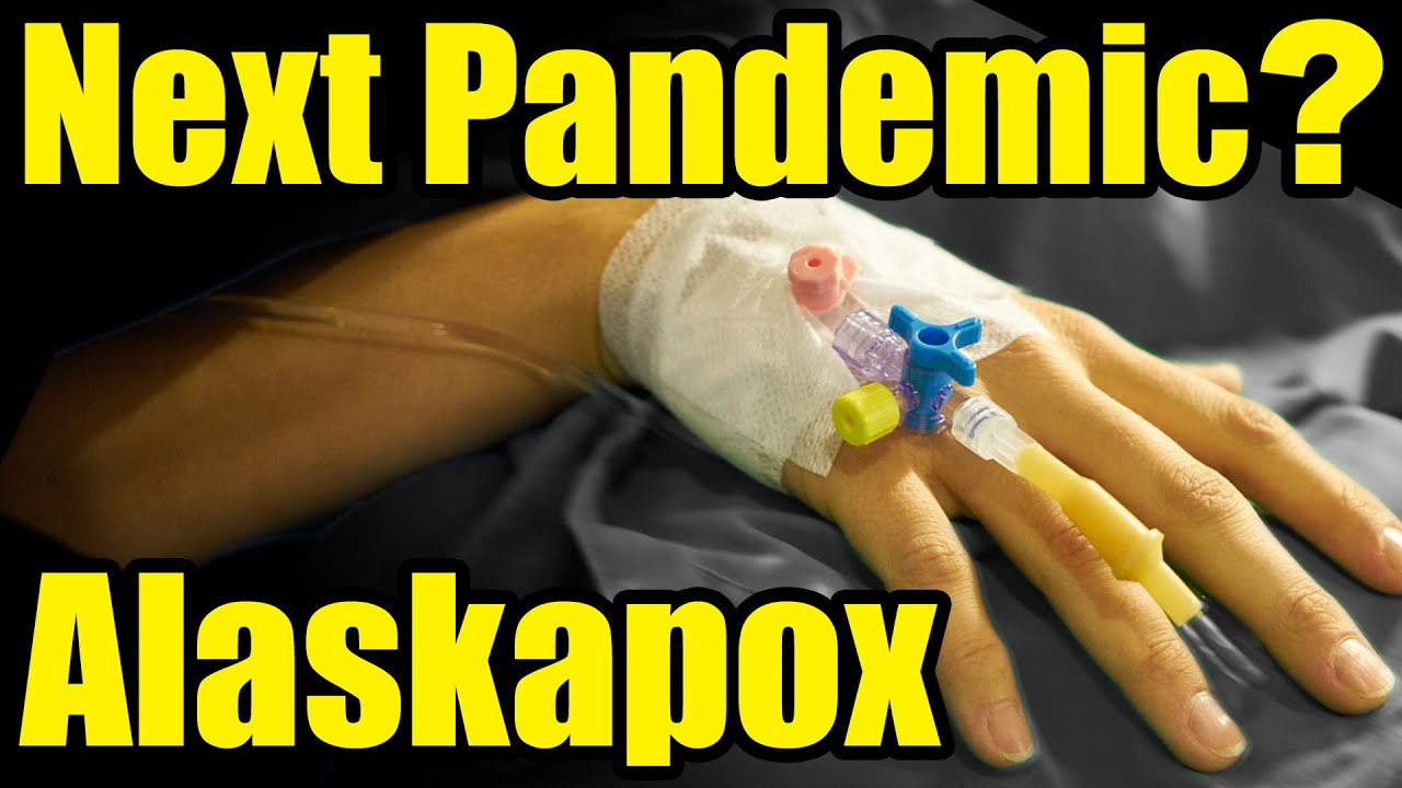 MUST SEE – Alaskapox – the Next PANDEMIC? – Hype or Serious Threat ...