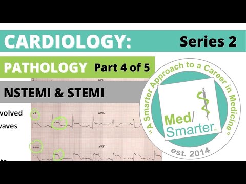 USMLE Step 1 | Cardiac: Pathology | MedSmarter | S2 Part 4 of 5 ...