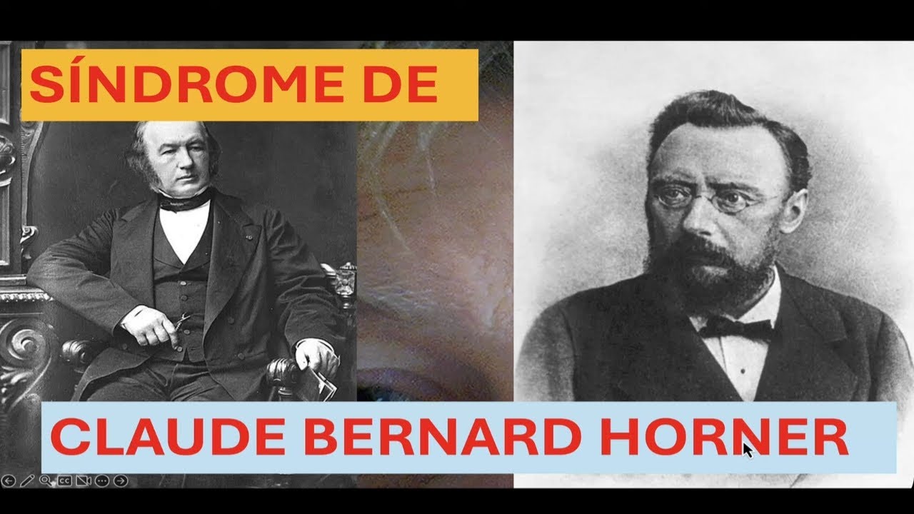 Síndrome de Claude Bernard-Horner - YouTube