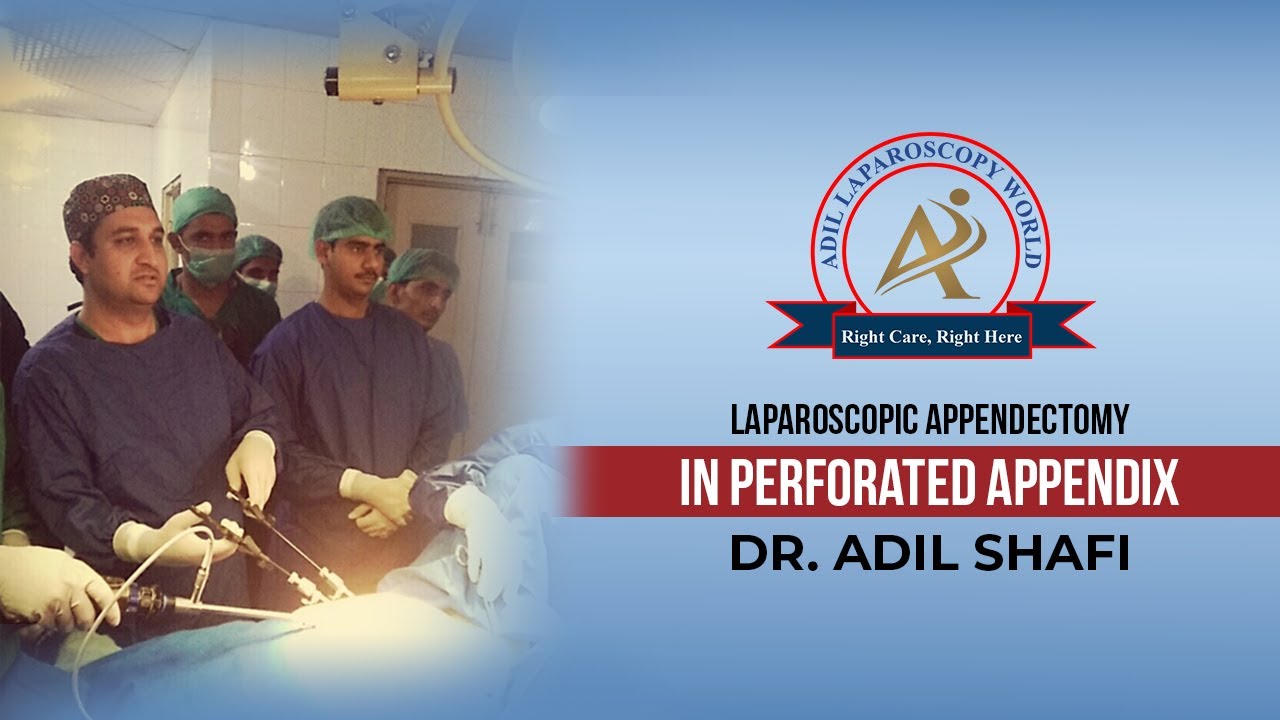 Laparoscopic Appendectomy In Perforated Appendix | Adil Laparoscopy ...