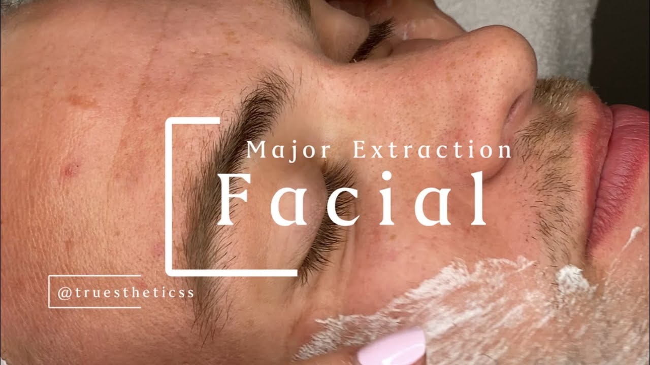 Major Extraction Facial: Waxing, High Frequency and Deep Relaxation ...