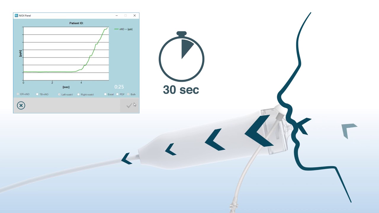 Using NIOX VERO® – Nasal Velum Closed Method - YouTube