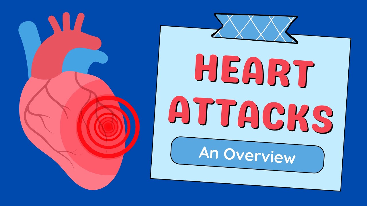 Heart Attacks Explained & what to do? - YouTube