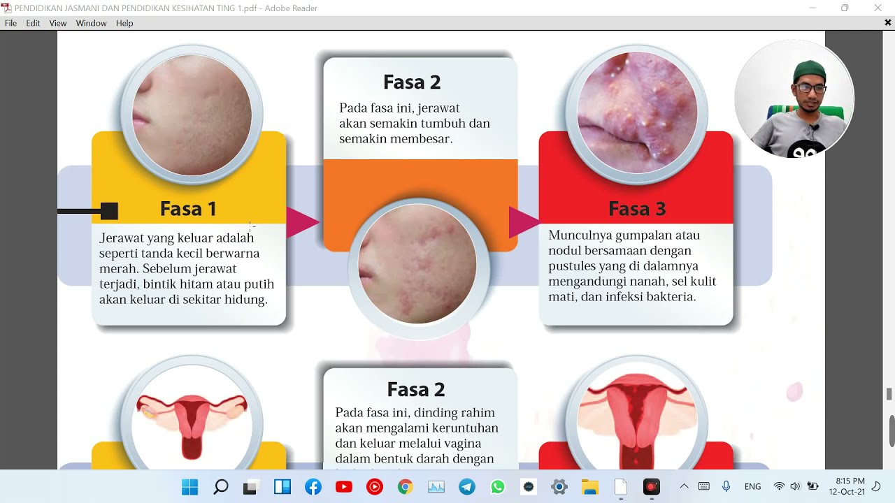 PJPK TINGKATAN 1 : 7.0 - PENYAKIT JERAWAT, SENGGUGUT, KANSER SERVIKS # ...