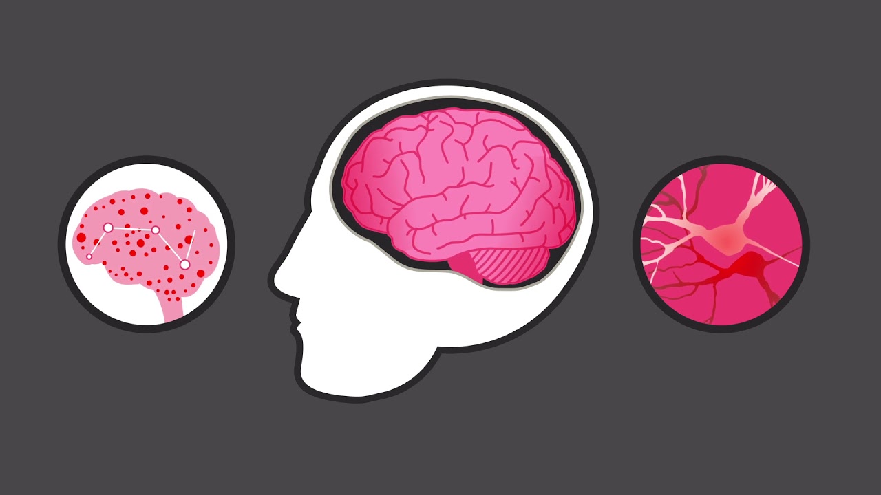 Our Approach - BRAINBox Solutions - YouTube