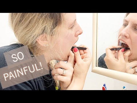 I PULLED OUT MY OWN TOOTH! IN SO MUCH PAIN! - YouTube