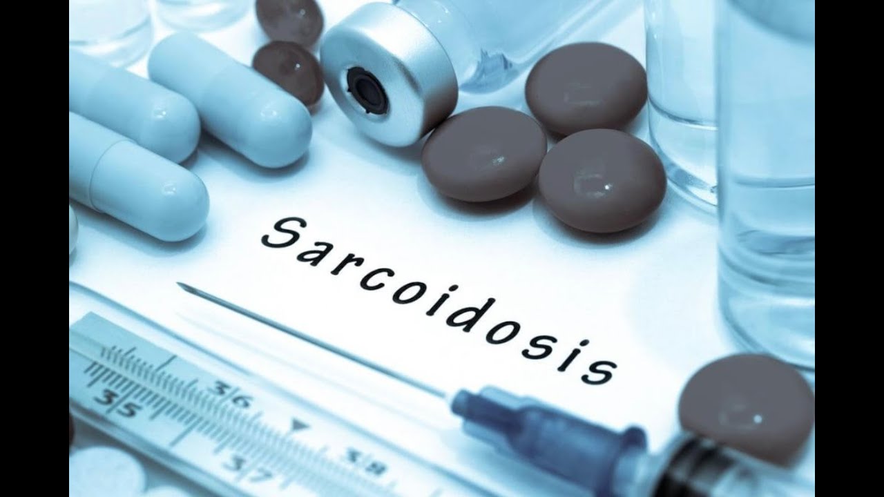 Sarcoidosis: A Simple Blood Test Diagnosis Coming Soon! - YouTube