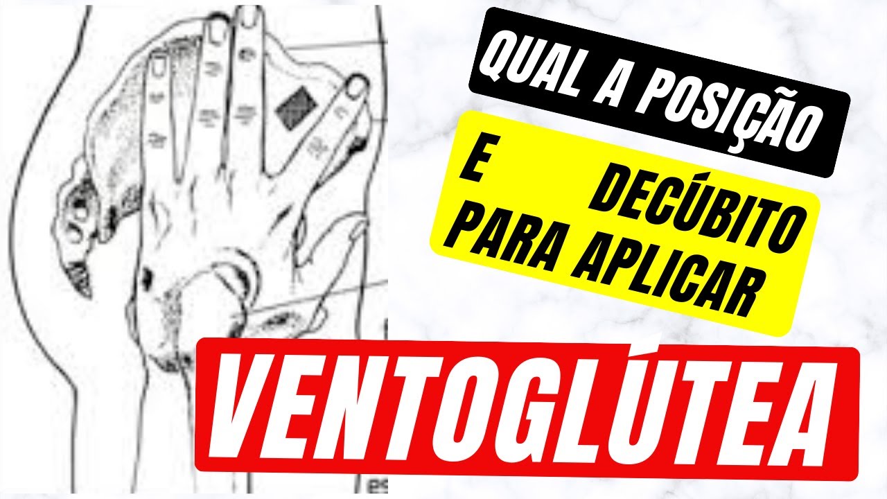Aula 12 - REGIÃO VENTROGLÚTEO (VG OU HOCHSTETTER), POSIÇÃO E DECÚBITO # ...