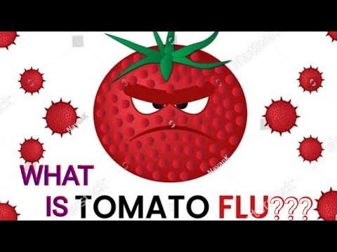 What is Tomato Flu | symptoms | causes | Treatment