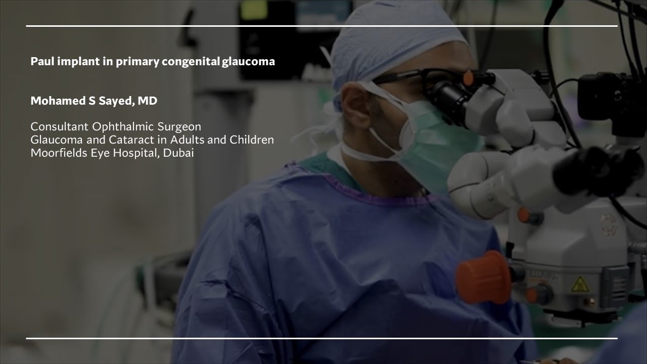 Paul implant in primary congenital glaucoma - YouTube