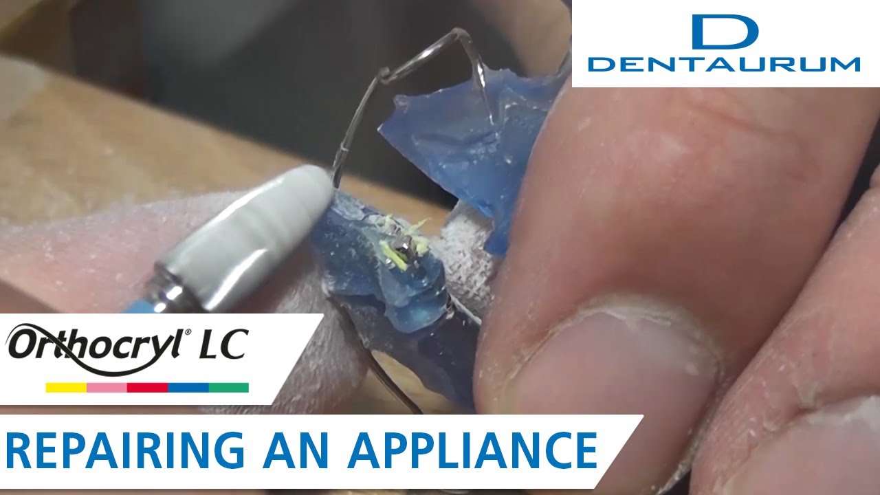 Orthocryl® LC – repairing an orthodontic appliance - YouTube