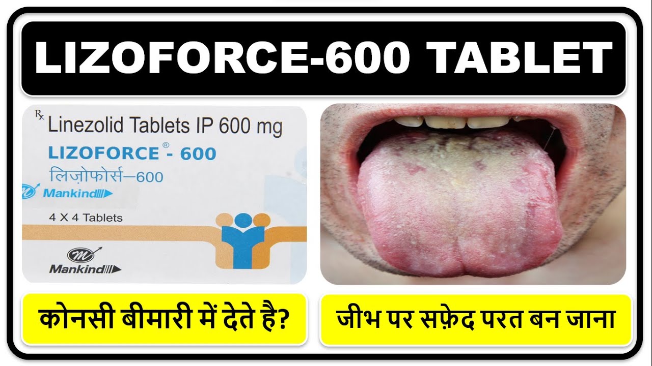 LIZOFORCE-600 TABLET, लिज़ोफोर्स टैबलेट सिर्फ 4 गोली काफी है ठीक करने ...