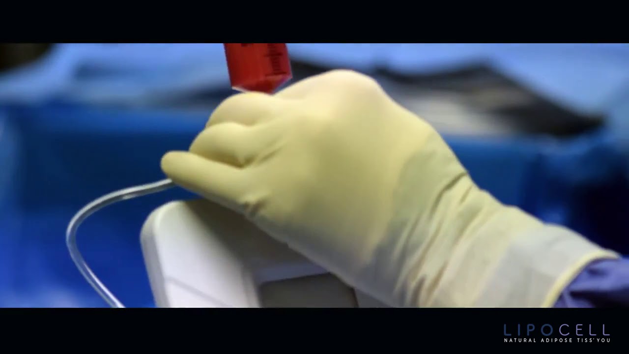 Procedura video Lipocell - YouTube