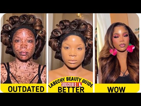 Flawless Foundation Routine for Acne-Prone Skin | Full Coverage Tips ...