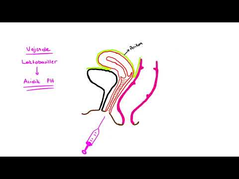 Kadın Genital Sistem Embriyolojisi ve Anatomisi