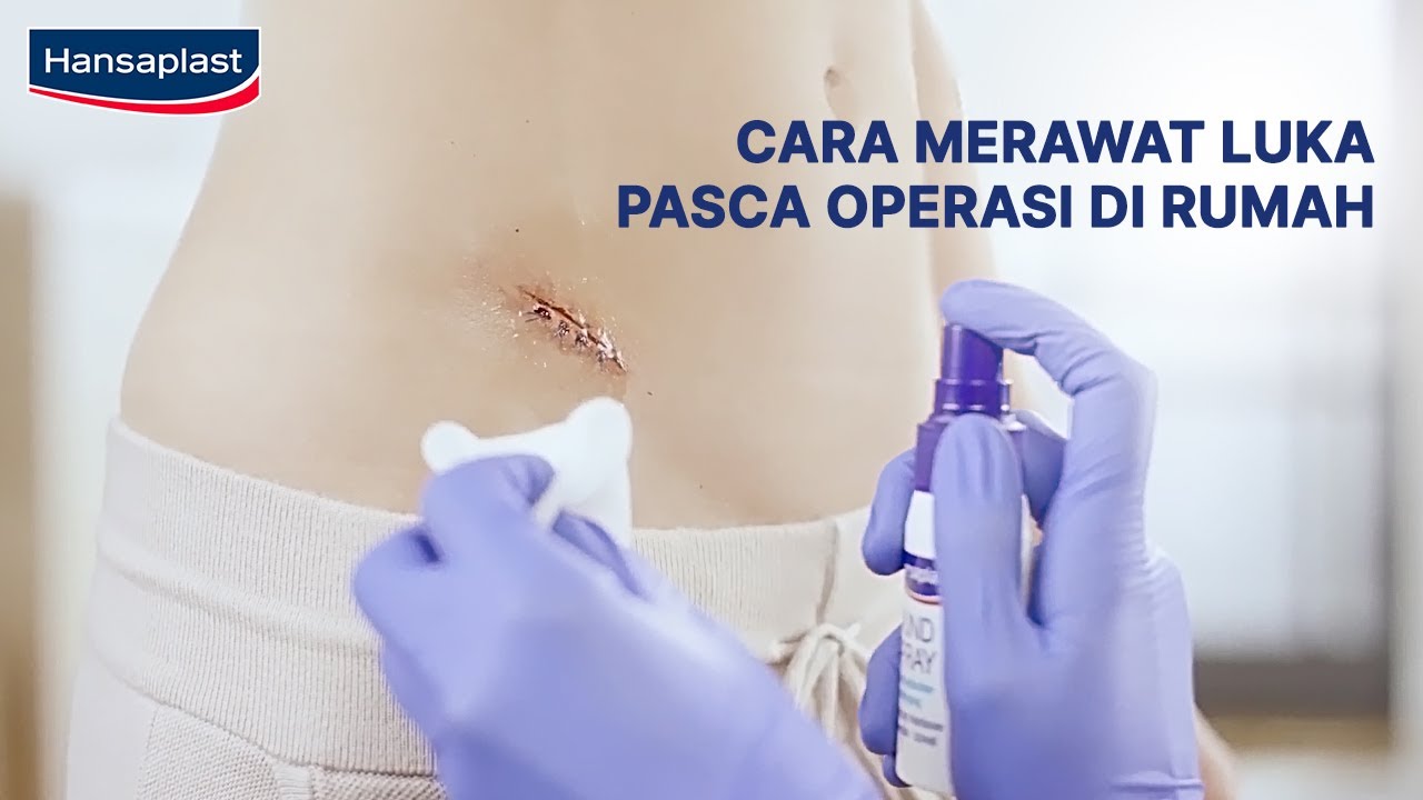 Cara Merawat Luka Pasca Operasi di Rumah - YouTube