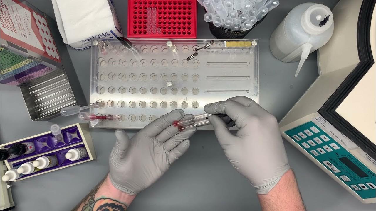 DAT Procedure - YouTube