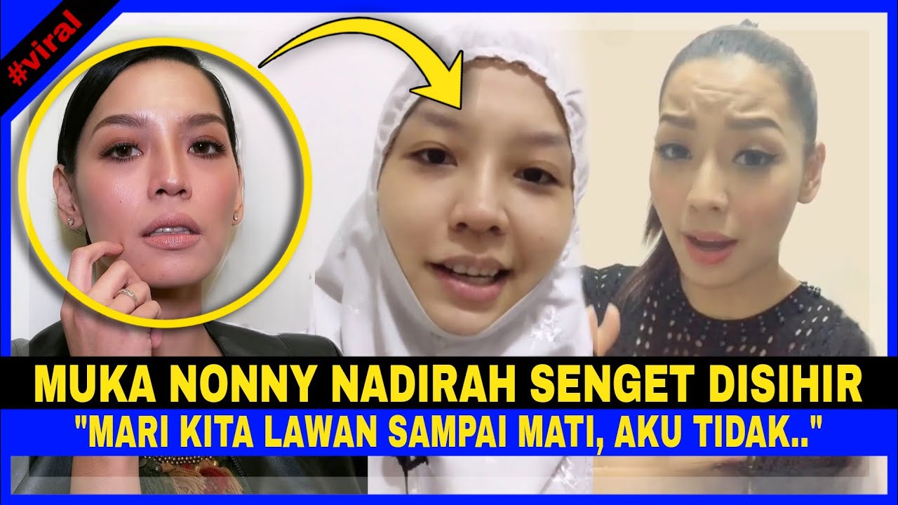 NONNY NADIRAH DEDAH MUKA SENGET Kena SIHIR, "Mari Kita LAWAN Sampai ...