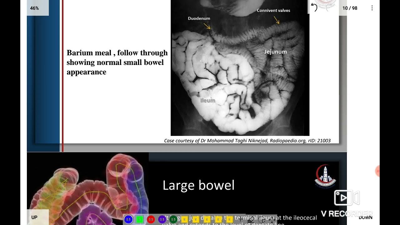 radiology (clinical git)by prof.soliman elshakhs - YouTube