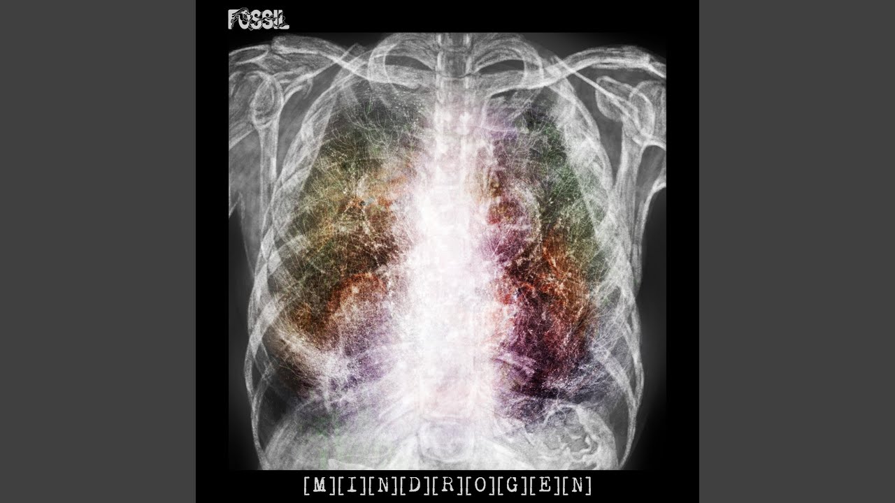 Junkie on Mindset Avenue - YouTube