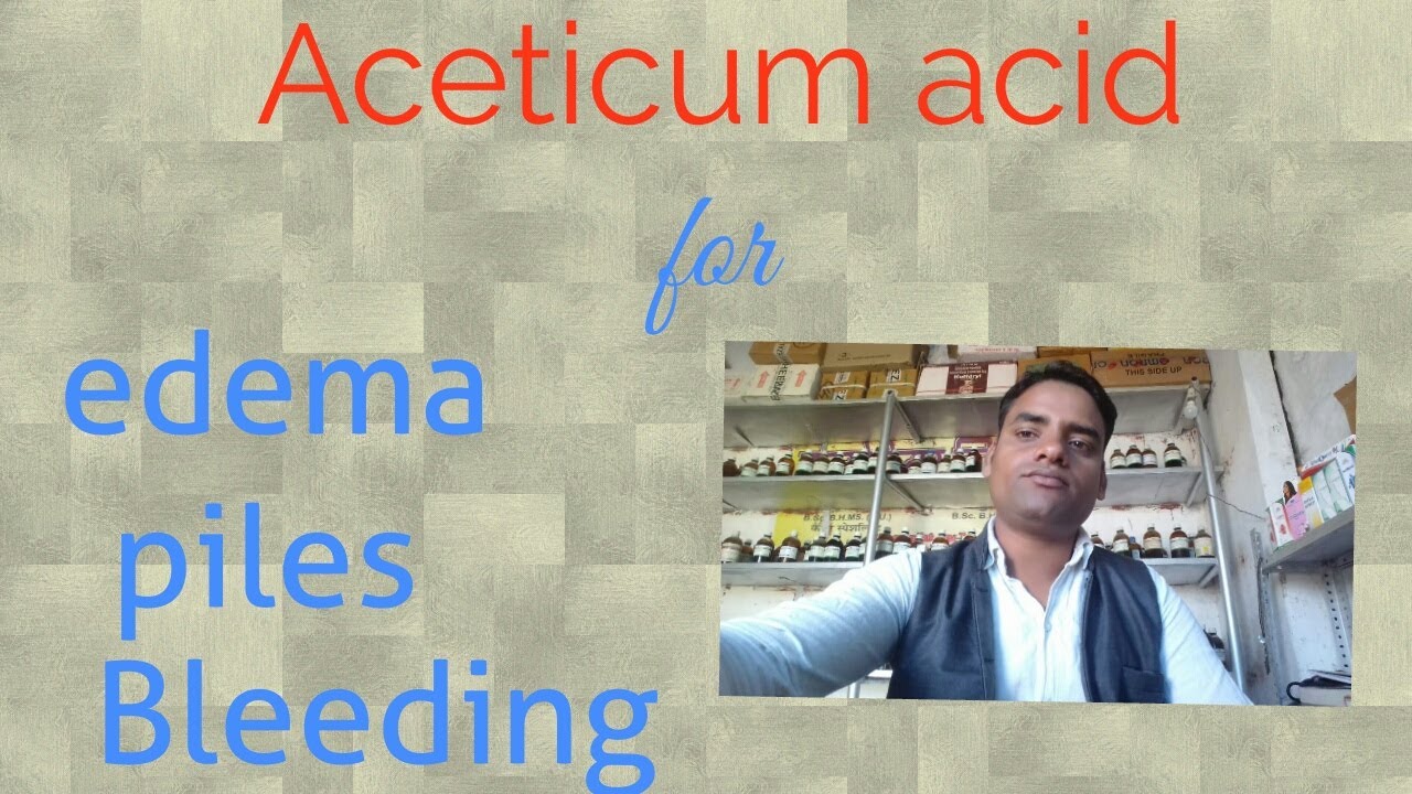 Aceticum Acidum ! Acetic Acid 30 Homeopathy Benefits - YouTube