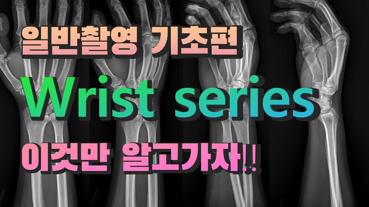 [일반촬영 기초편] Wrist series - YouTube