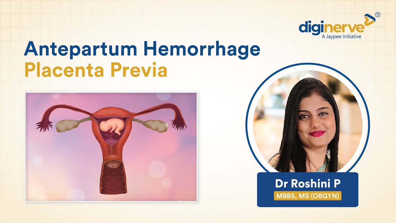 Understanding 'Antepartum Hemorrhage: Placenta Previa' - Insights from ...
