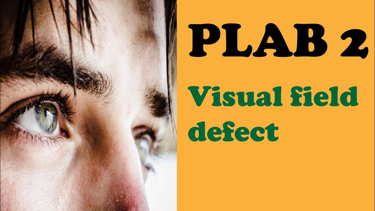 PLAB 2: Visual field defect| OSCE - YouTube