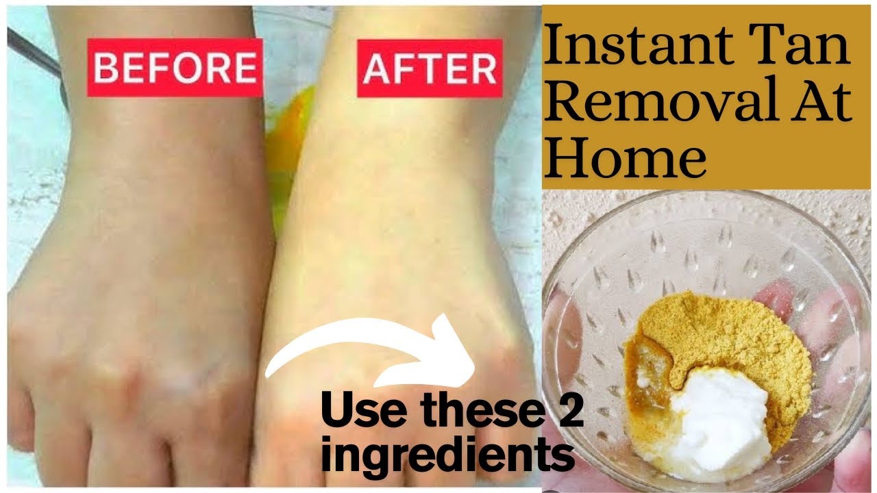 Remove Sun Tan at home |Tan Removal In 1 Day Home Remedies😊 - YouTube