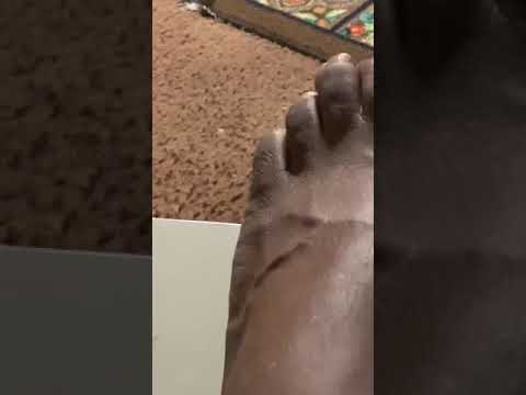 Twitching pinky toe - YouTube