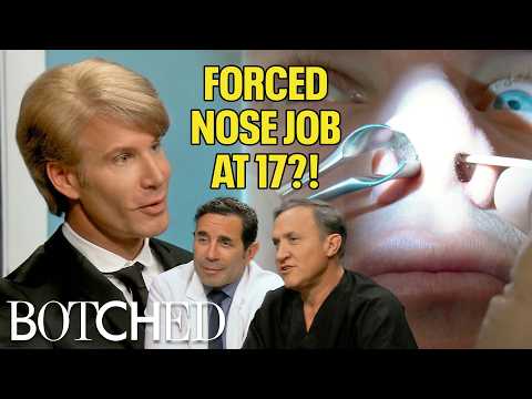 Robert's Mom FORCED Him To Get A Nose Job at 17 Years Old?! | Rejected By Botched | E!
