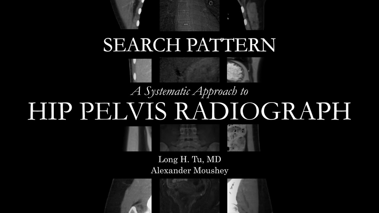 [XR] Hip Pelvis Radiograph | Search Pattern - YouTube