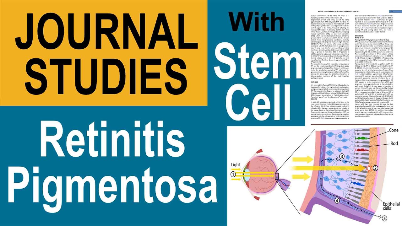 JOURNAL STUDIES || RETINITIS PIGMENTOSA || STEM CELL TREATMETN | DR ...