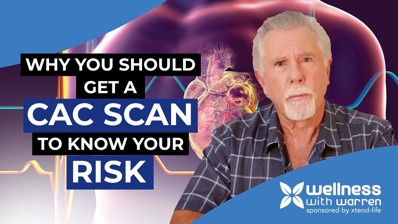 Why you should get a CAC scan to know your risk for a heart attack or ...
