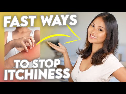 Stop Itchy Eczema (easy remedies!)