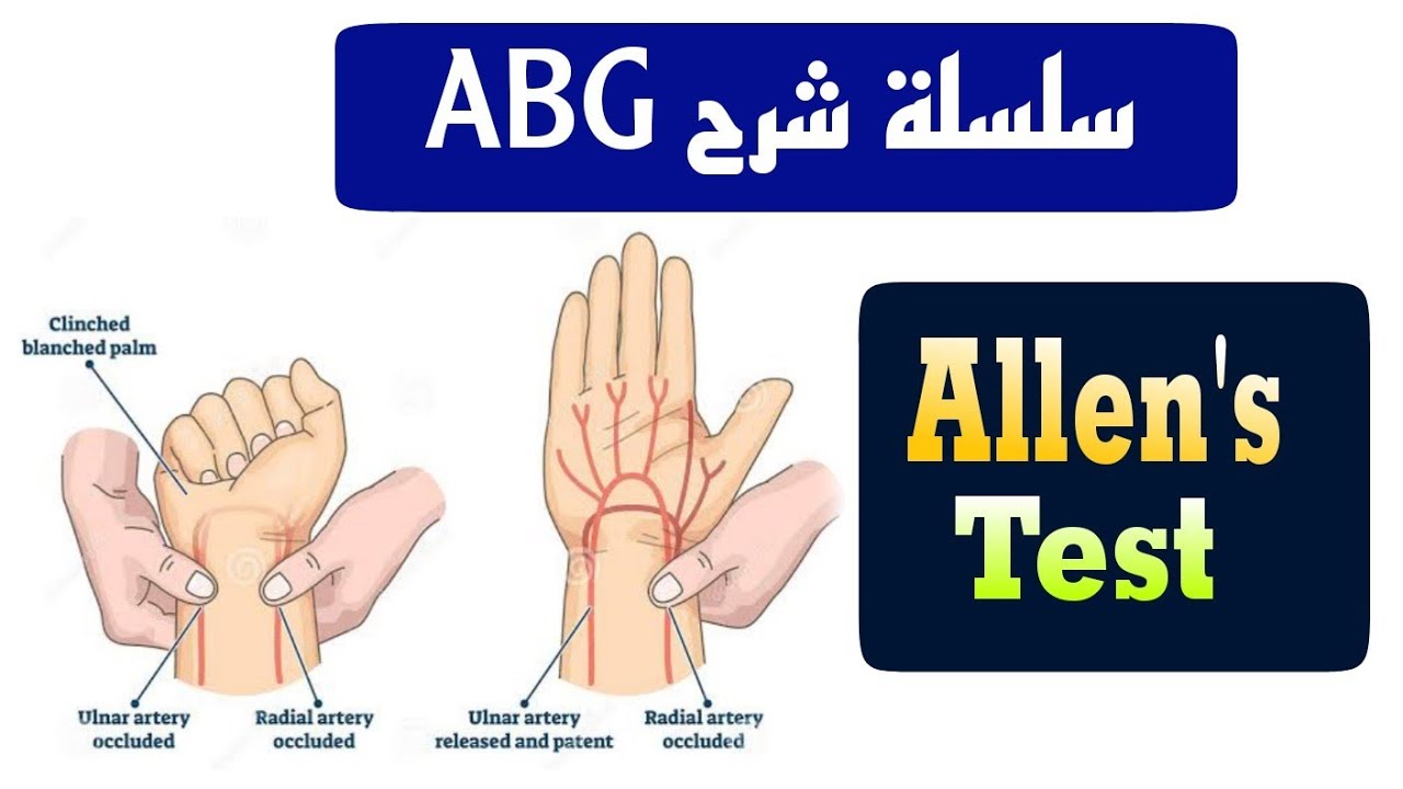 Allen's test | سلسلة تحليل غازات الدم الشرياني - YouTube