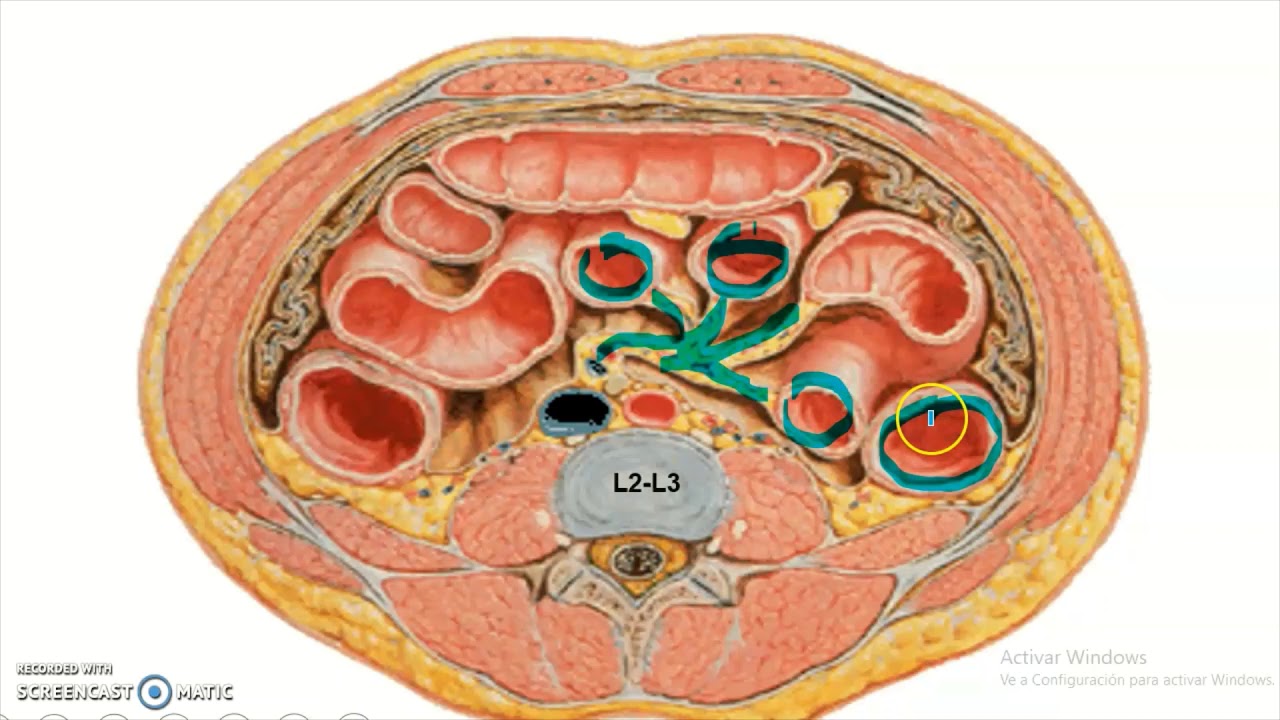 PERITONEO - DISPOSICIÓN GENERAL - YouTube